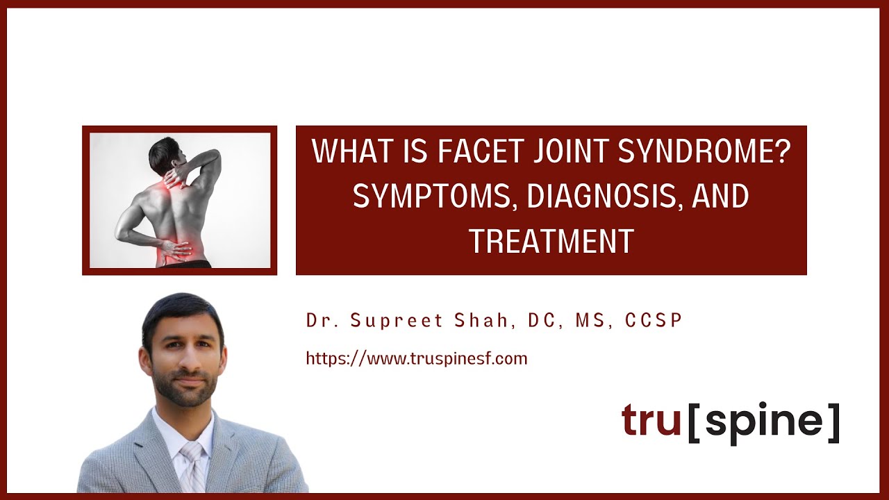 What is Facet joint syndrome? Symptoms, diagnosis, and treatment - YouTube