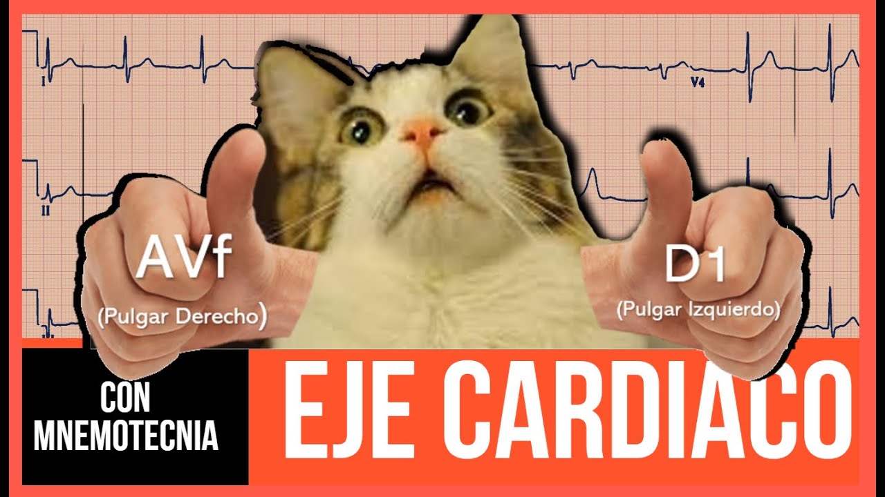Paso 4. Cómo CALCULAR el EJE CARDIACO de manera FÁCIL y SENCILLA ...