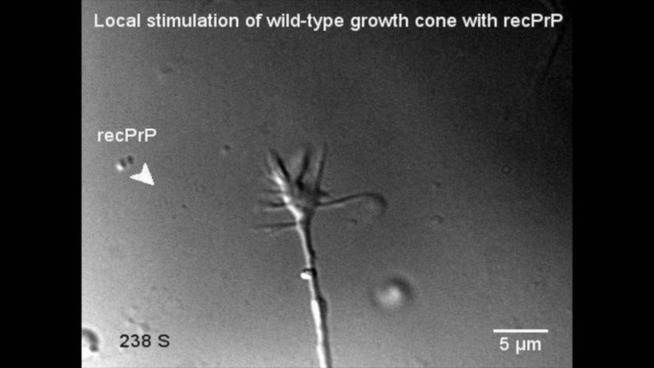 PrP induces neurite growth and cone growth turning - YouTube
