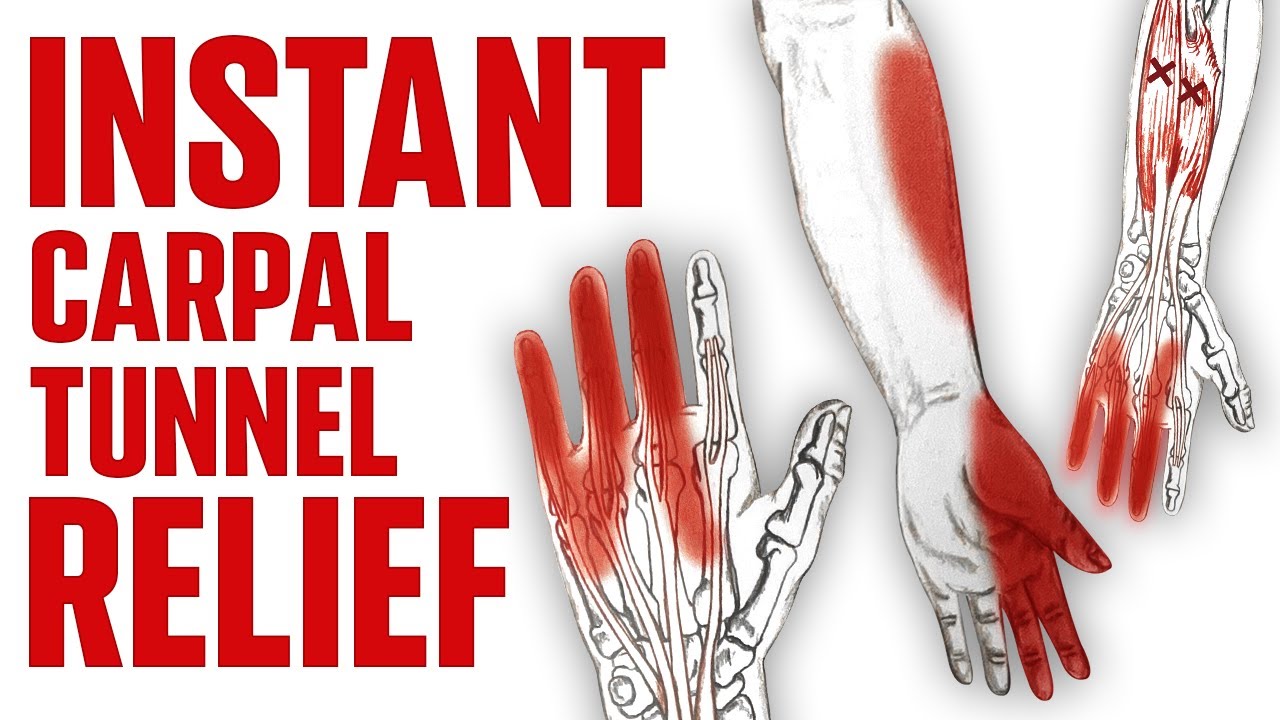 How to Fix Carpal Tunnel - 2 EASY STEPS - YouTube