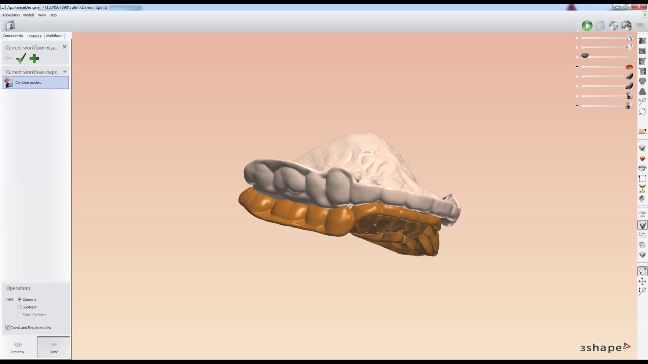 How to design a Digital Damon Splint in 3Shape - YouTube