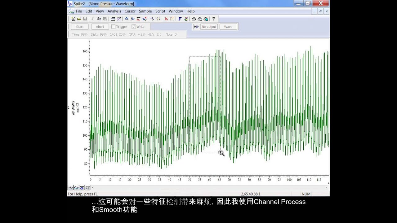 Spike2 视频教程: 活动指针和血压 (BP_CursorsC) - YouTube