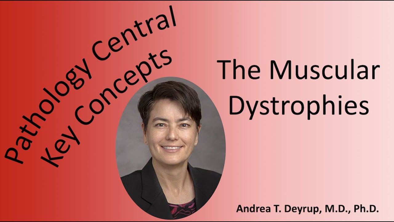 Medical School Pathology: Pathophysiology of Muscular Dystrophy - YouTube