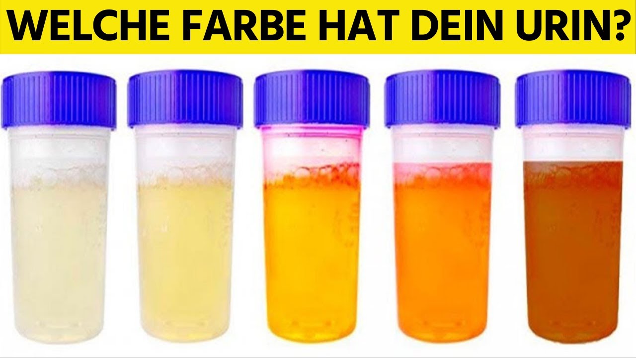 Was die Farbe deines Urins über deine Gesundheit aussagt - YouTube