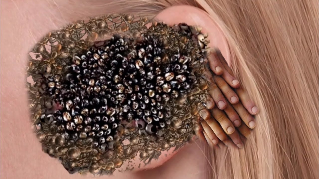 ASMR Animation Treatment from Infected The Ears| 2D Animation Treatment ...