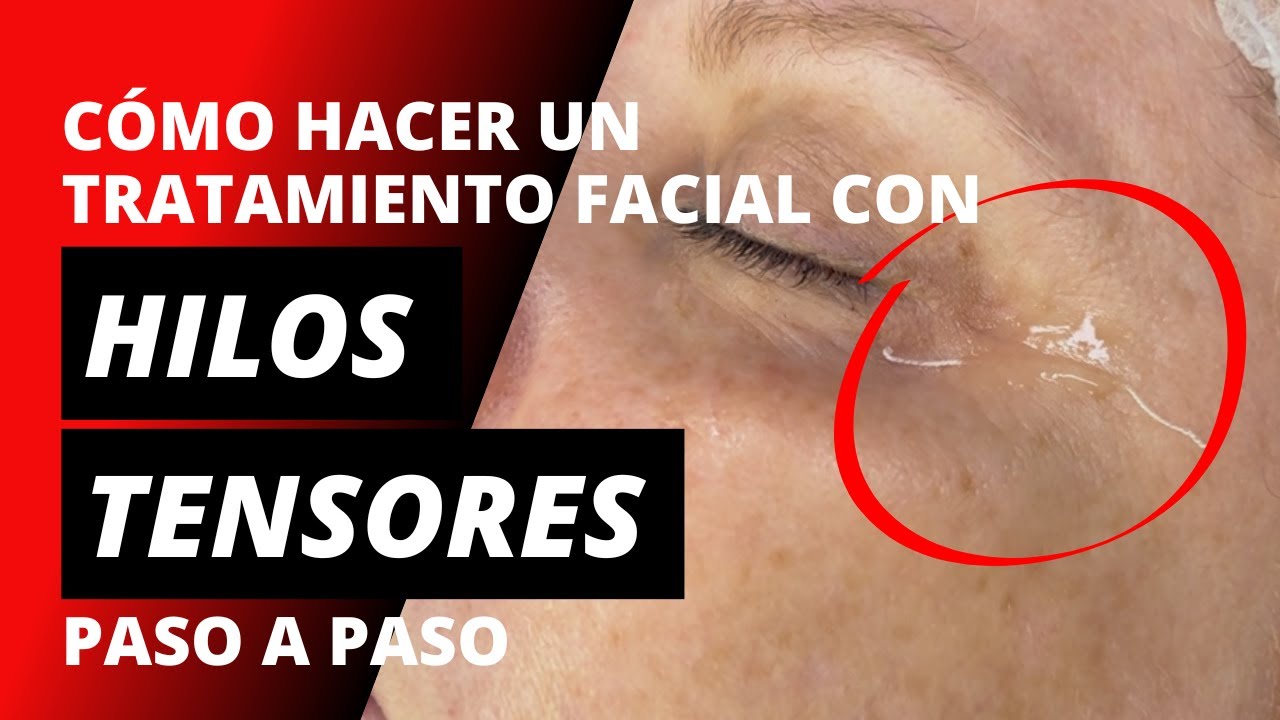 Tutorial hilos tensores absorbibles de colágeno - YouTube