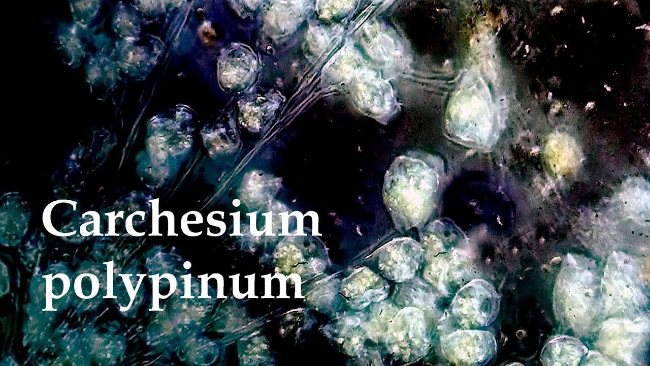 Carchesium polypinum - YouTube