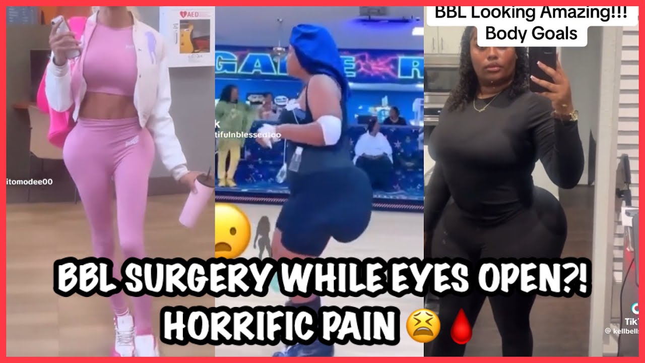 AWAKE WHILE FAT IS SUCKED OUT?!| BOTCHED BBL| COMPILATION VIDEO ...