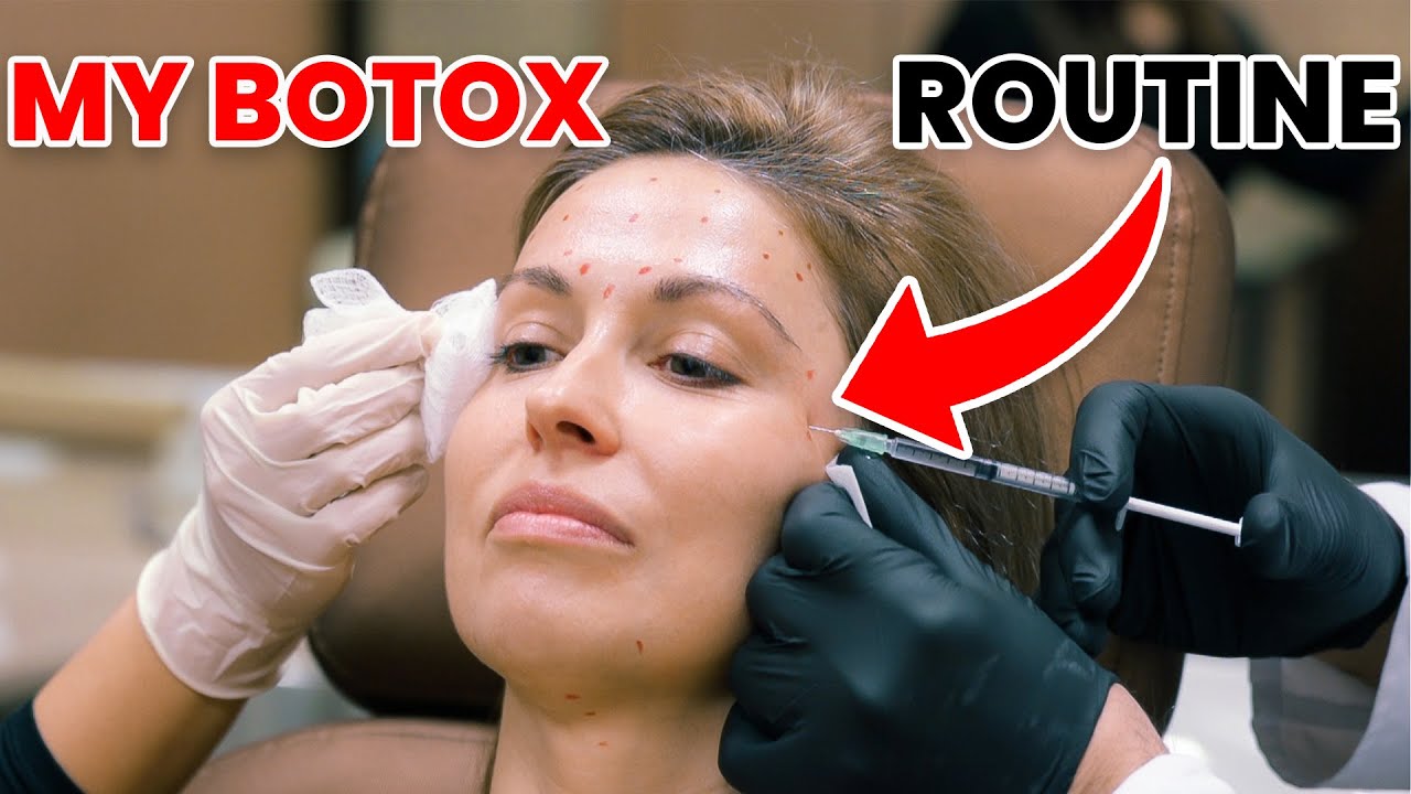 The Botox I Ask My Plastic Surgeon for to Look YOUNG! - YouTube