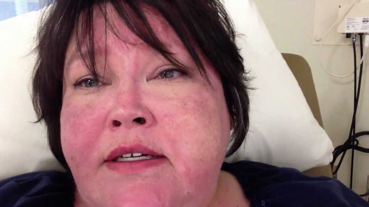 Lupus 11-15-12 Rituxan and IViG Infusions - YouTube