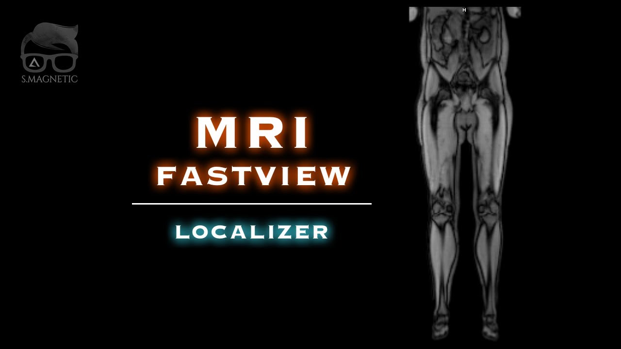 MRI – FASTVIEW LOCALIZER - YouTube