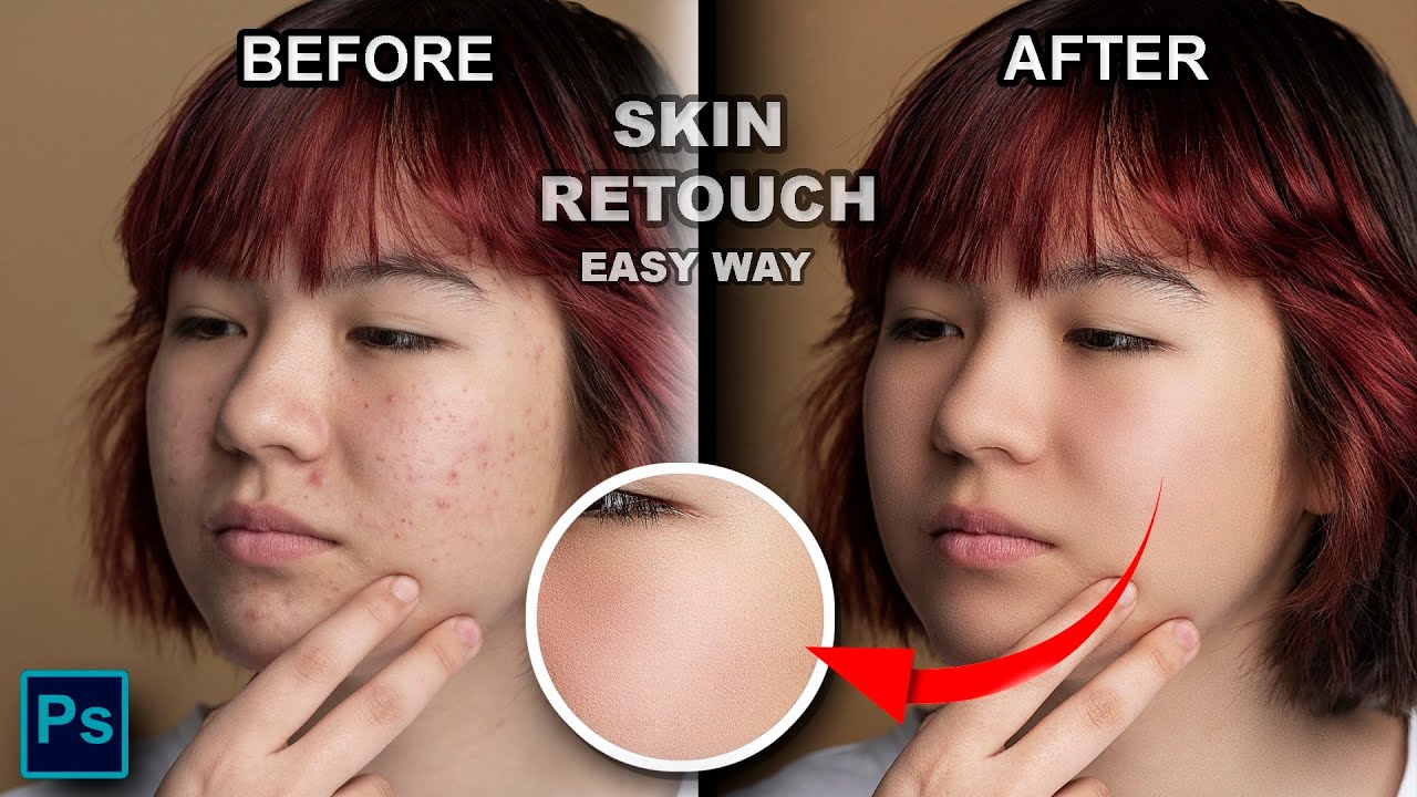 fastest way to skin retouching | High end skin retouching technique ...