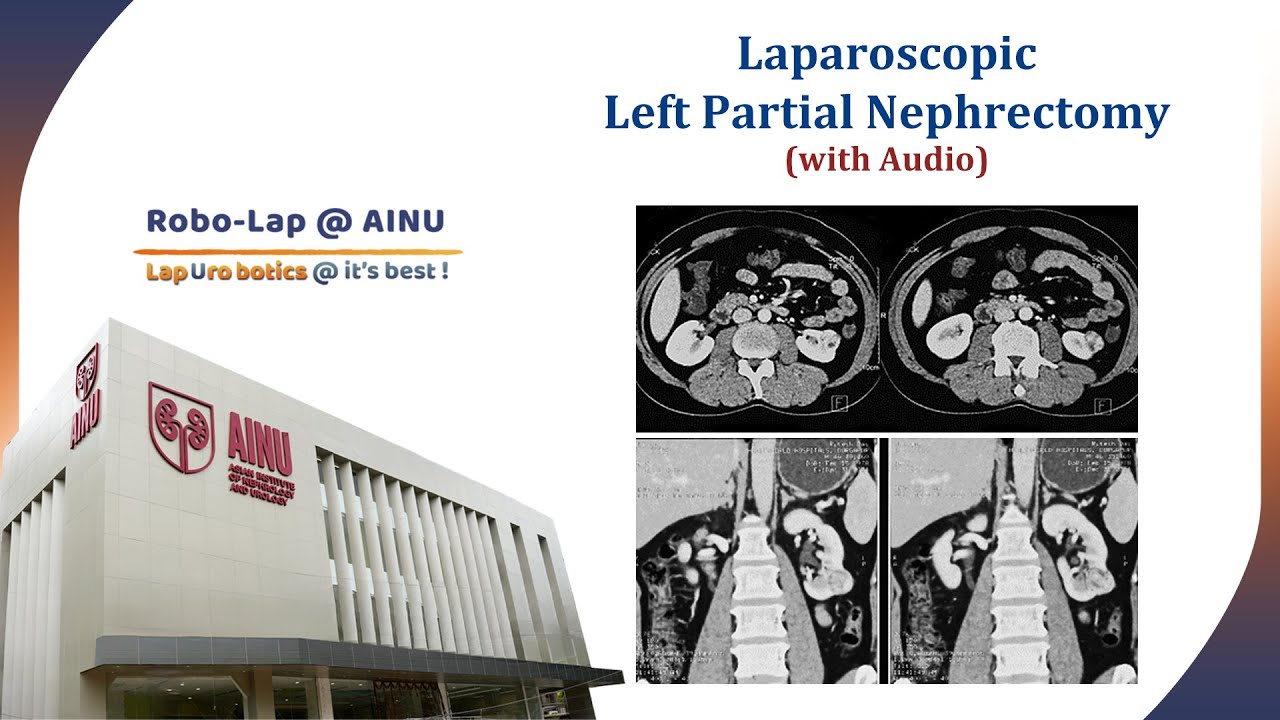Laparoscopic Left Partial Nephrectomy with Audio | RoboLap@AINU 2025 ...