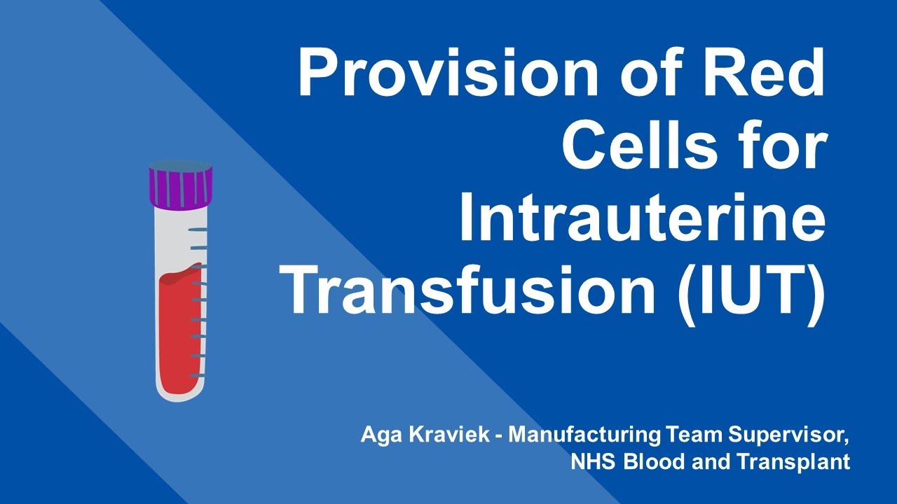 London RTC Education Session - Provision of Red Cells for Intrauterine ...