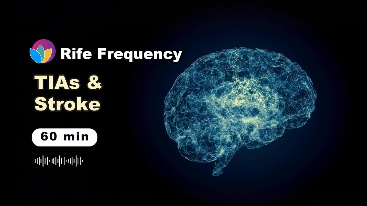 Silent Brain Attack WARNING | TIA/Stoke Prevention & Recovery | Rife ...