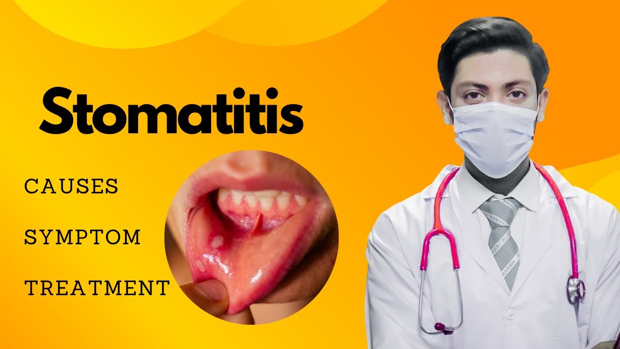 "Stomatitis: Symptoms, Causes, and Treatment | Comprehensive Guide for ...