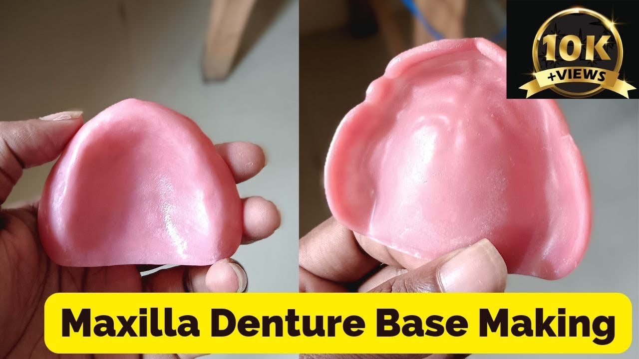 How to make Denture Base by Sprinkle Method | Cold cure Acrylic Resin ...