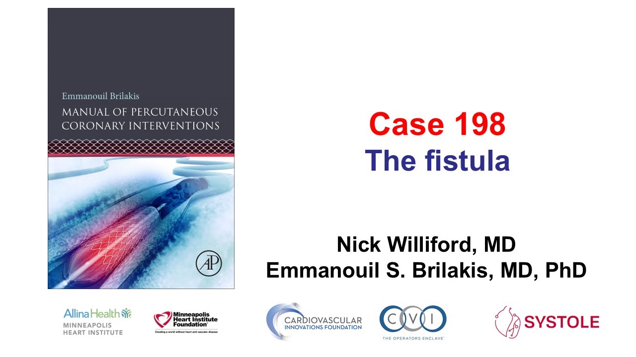 Case 198: Manual of PCI - The fistula - YouTube