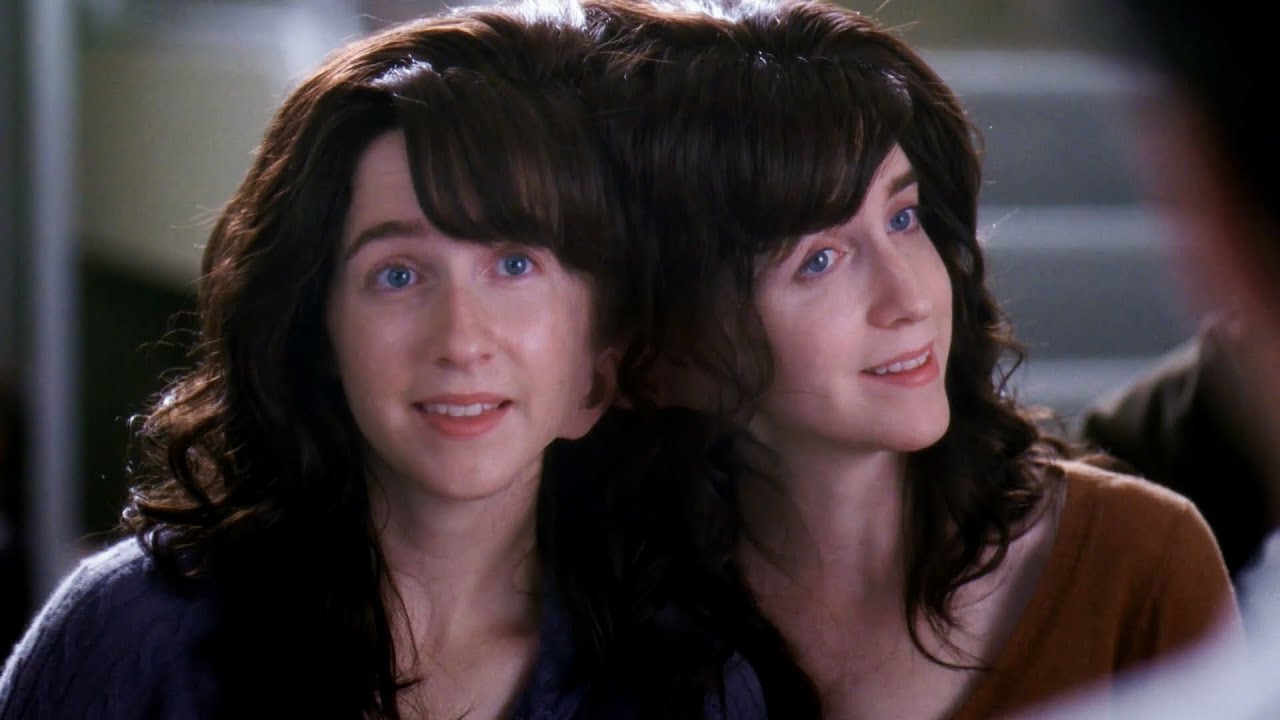 Two sisters with heads conjoined for 25 years. - YouTube