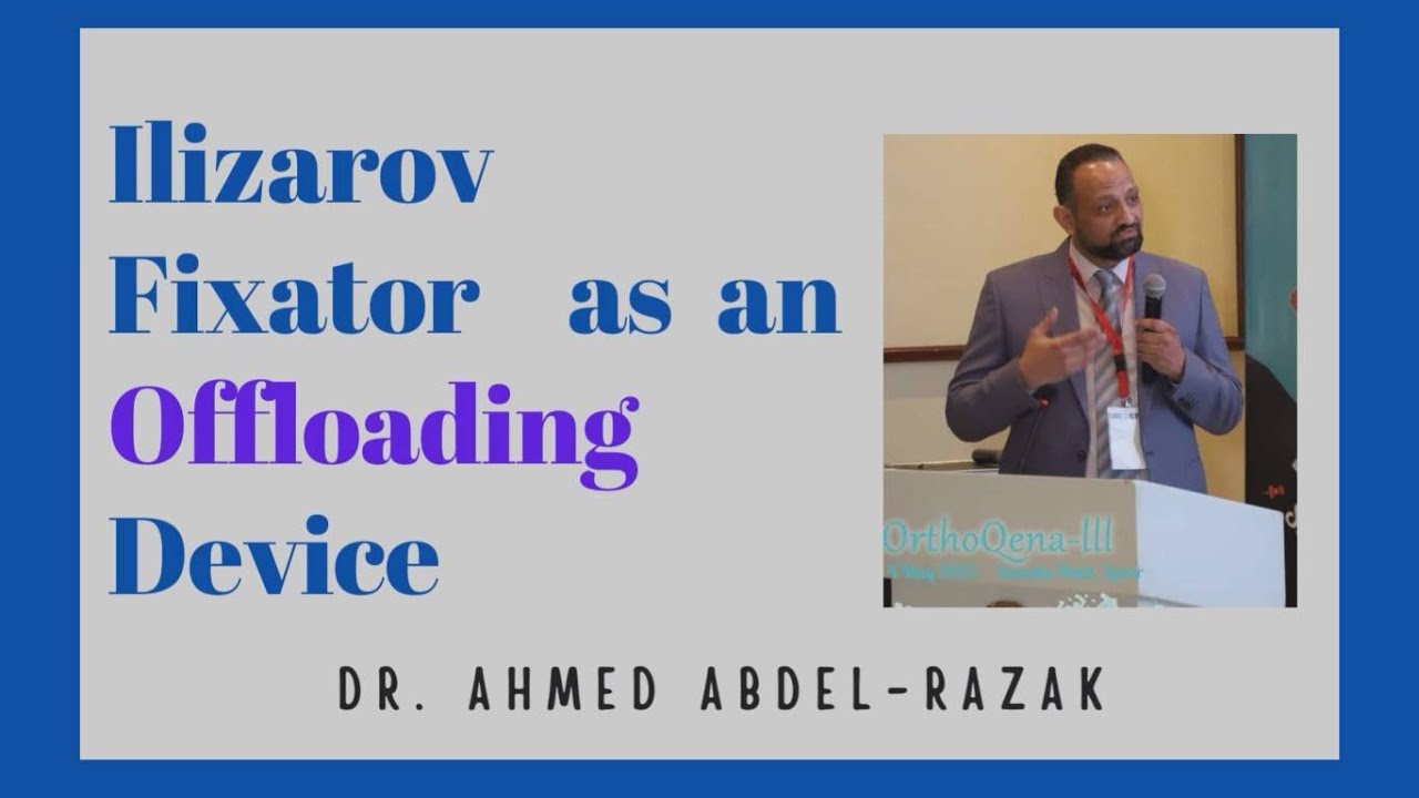Use of the Ilizarov Fixator as an Offloading Device - Dr Ahmed ...