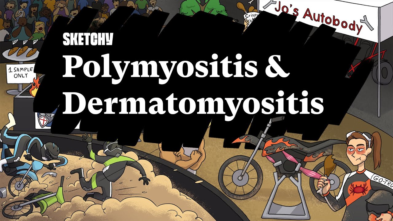 Path Study Guide: Polymyositis & Dermatomyositis | Sketchy Medical ...