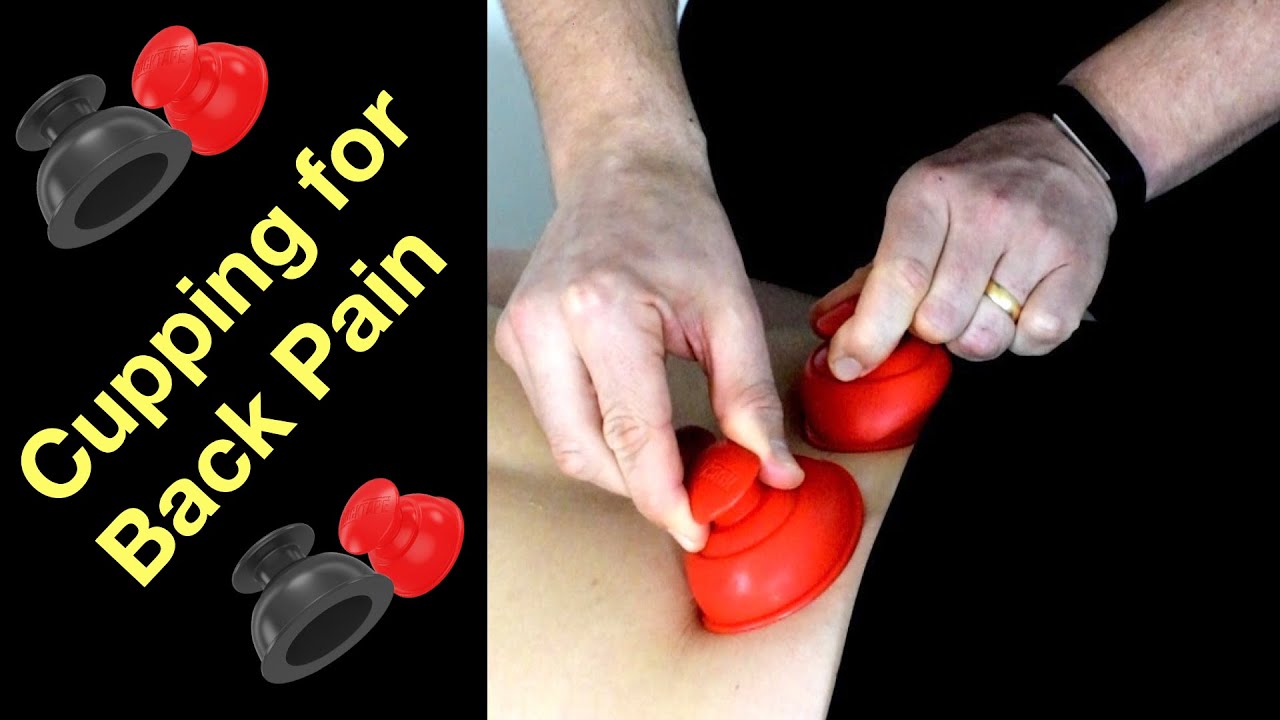 The best way to cup for back pain | RockPods to reduce back pain. The ...