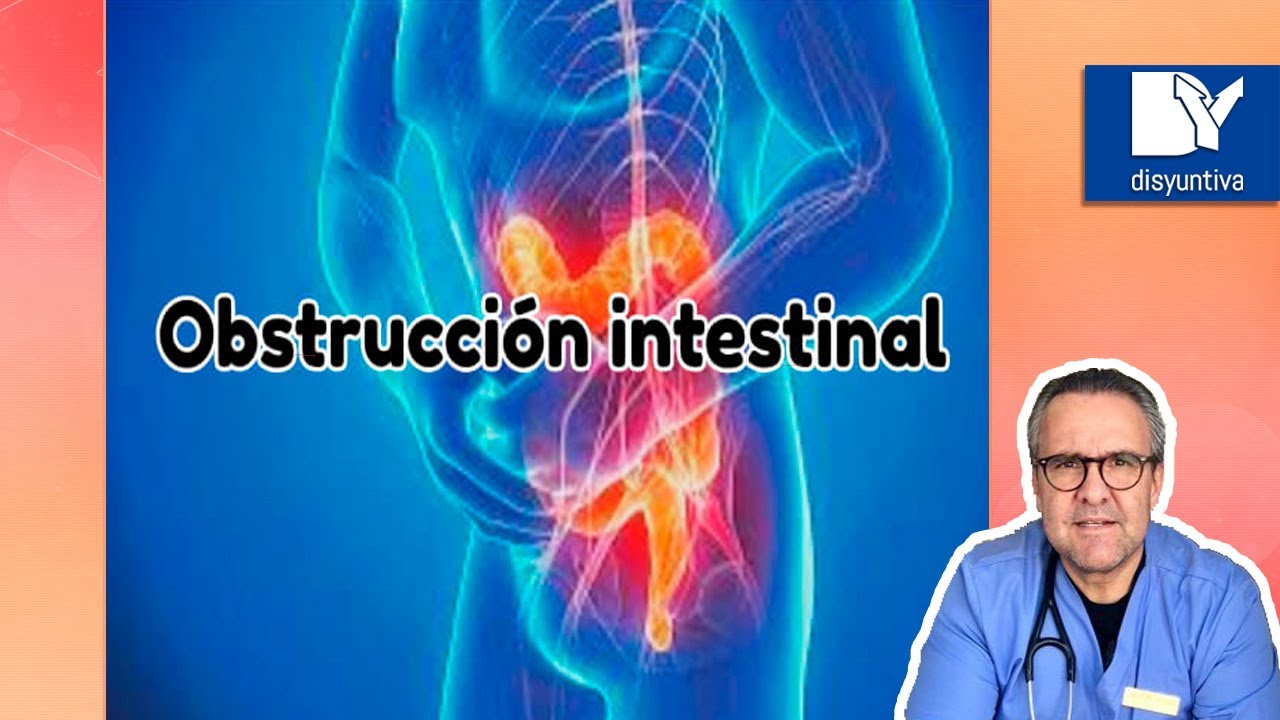 Salud | Oclusión intestinal - YouTube
