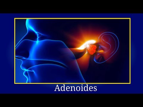 ADENOIDE