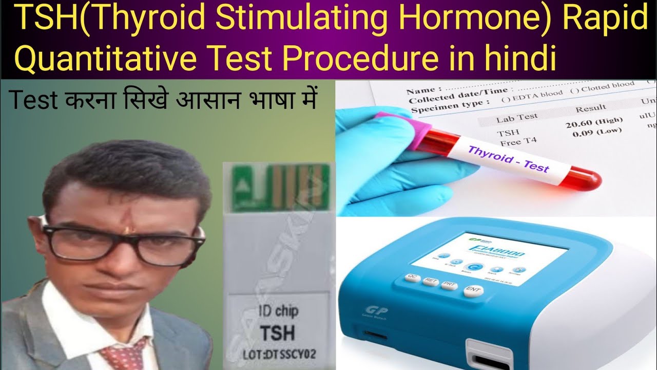 Thyroid Stimulating Hormone (TSH) Rapid Quantitative Test Procedure in ...