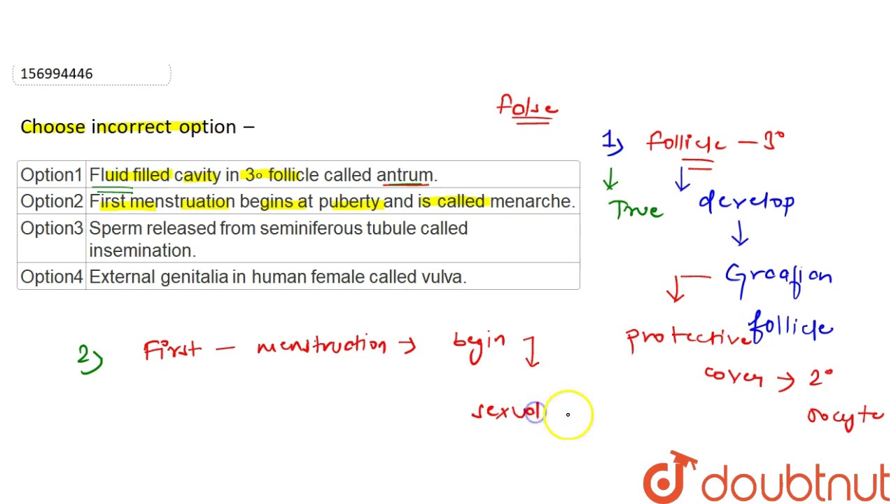 Choose incorrect option – - YouTube