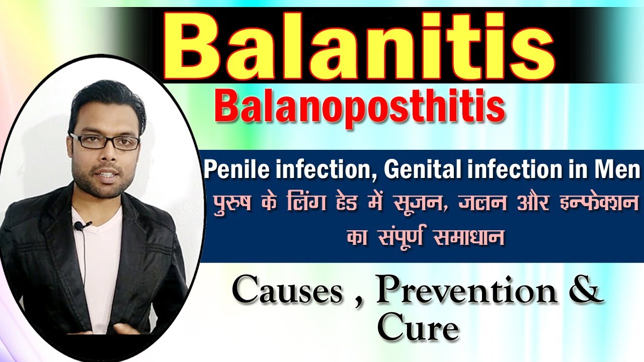 लिंग में दाने, जलन या इन्फेक्शन का सम्पूर्ण इलाज | Balanitis cure ...