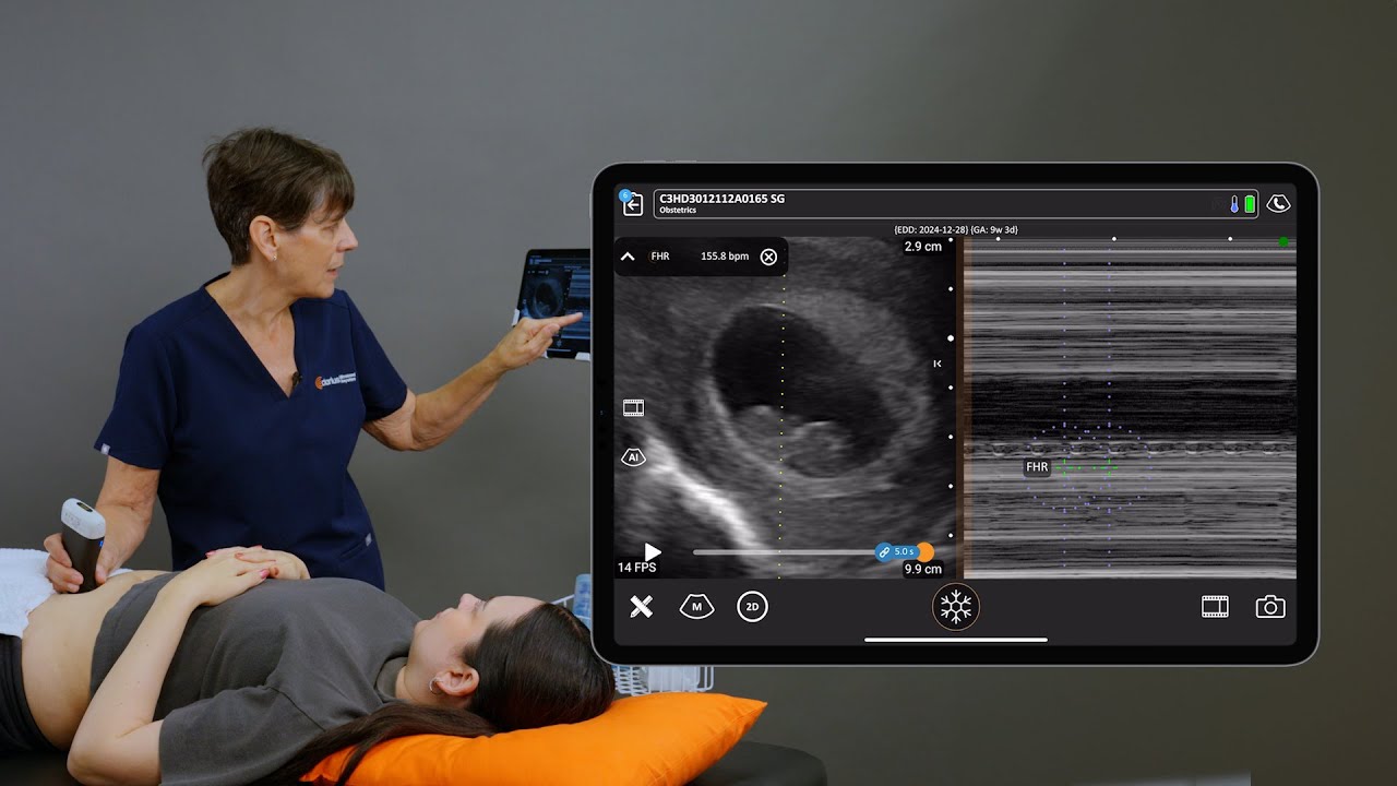 M-Mode - Fetal Heart - YouTube