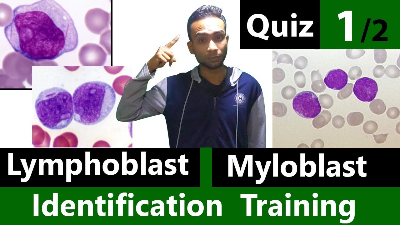 Lymphoblast Vs Myeloblast What Is Blood Cancer? Blood Cancer