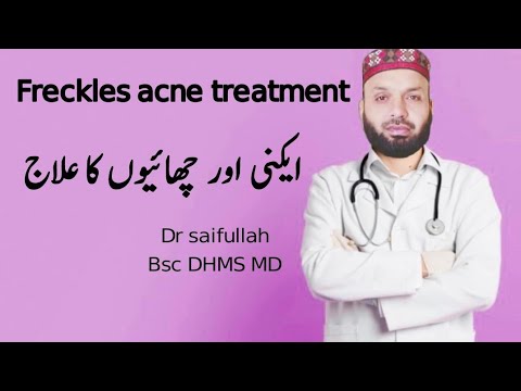 Freckle Causes Signs and Symptoms Diagnosis and Treatment - YouTube