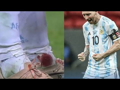Lionel Messi plays with a bleeding ankle 💔 Rare Footage. - YouTube