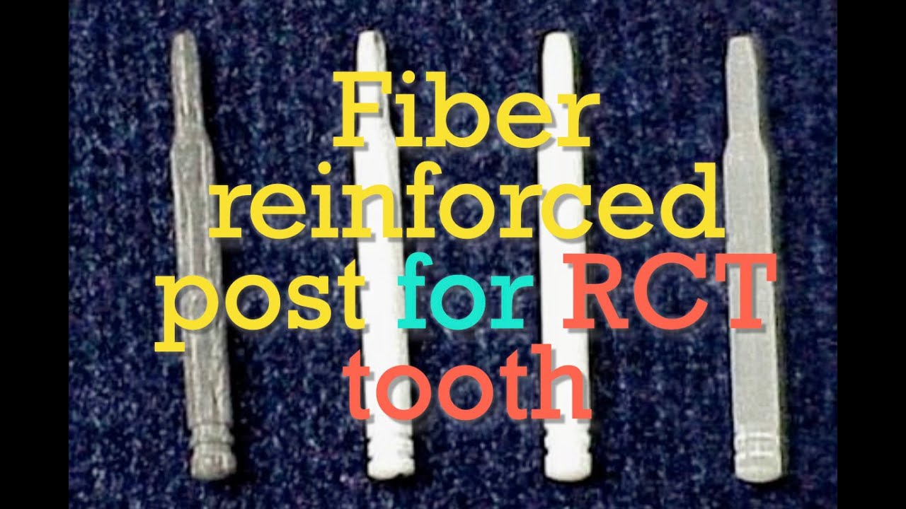 Fiber reinforced post for RCT tooth - YouTube