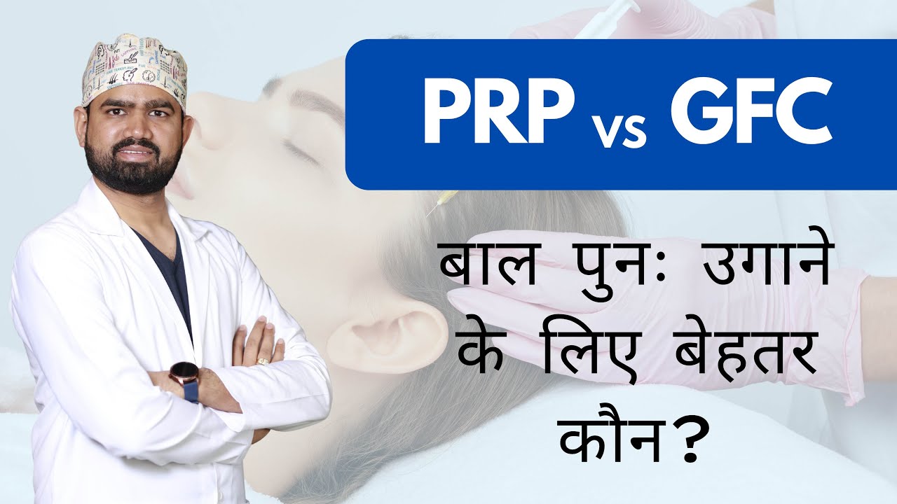 GFC vs PRP Which is the Best for Hair Loss? | GFC or PRP में कौन बेहतर ...