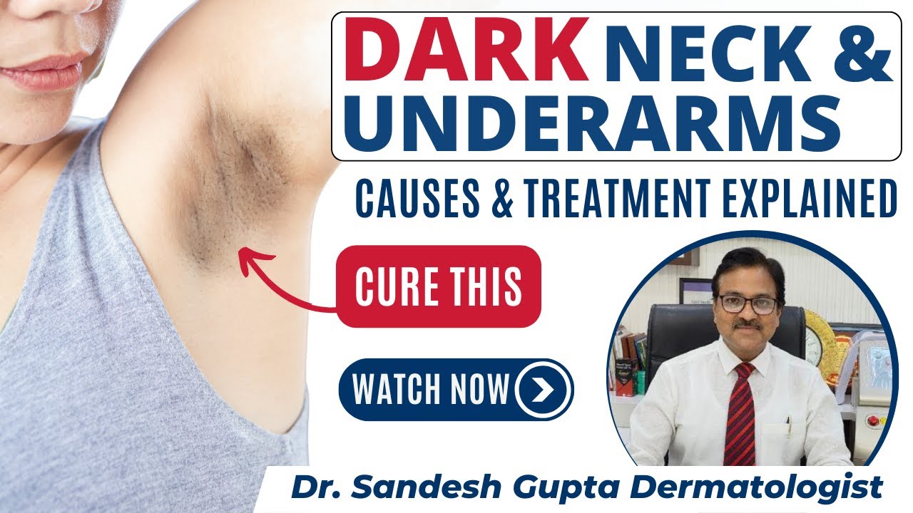 Dark Neck & Underarms || Causes & Treatments Of Dark Neck & Underarms ...