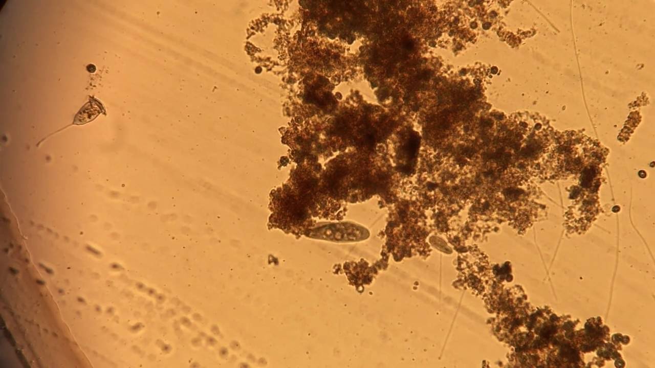 Ciliater: To tøffeldyr, ett klokkedyr og en Colpidium colpoda - YouTube