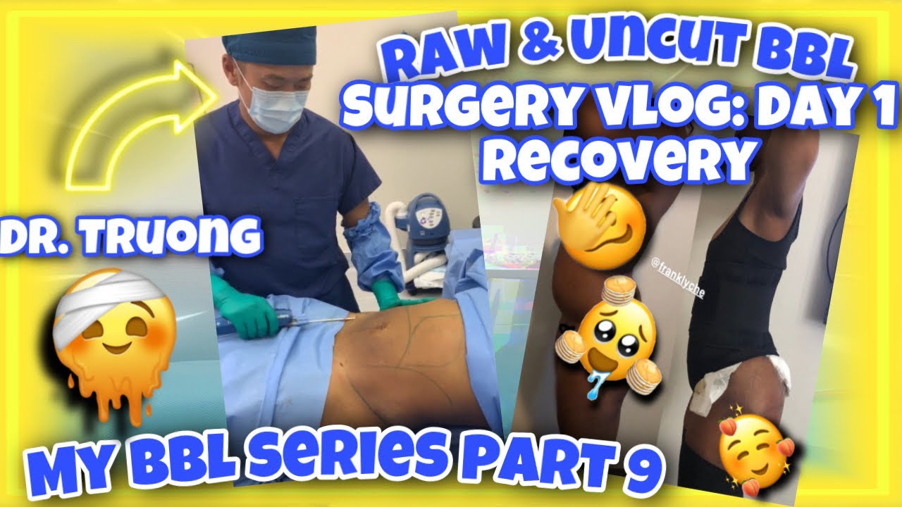 Brazilian Butt Lift (BBL): My BBL Surgery Series: Raw & Uncut Surgery ...