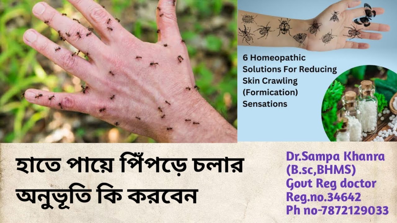 Formication/ Tecktile hallucination Cause, Treatment, Medicine গায়ে ...