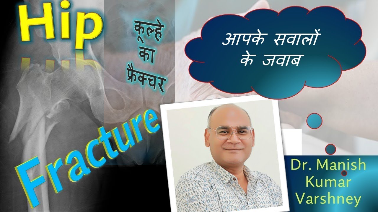 Questions and answers after hip fracture fixation with PFN FULL - YouTube