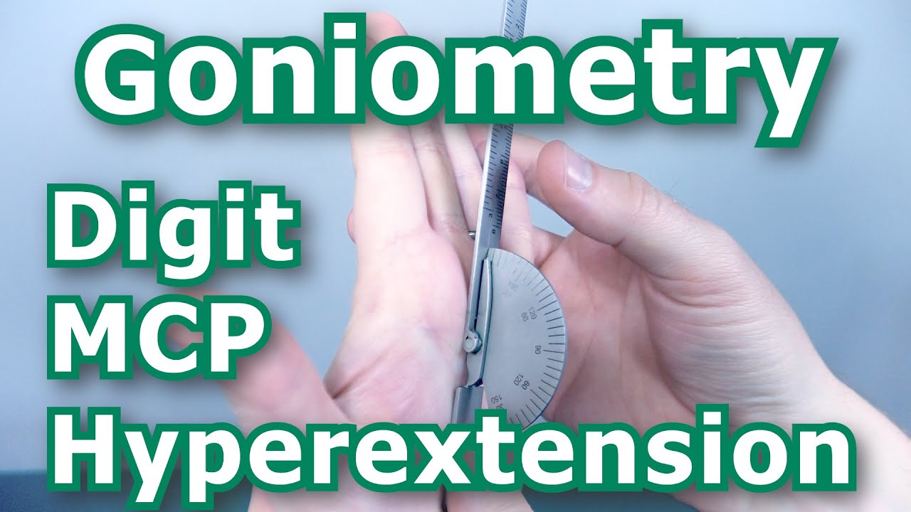 Goniometry - Digit MCP Hyperextension - YouTube