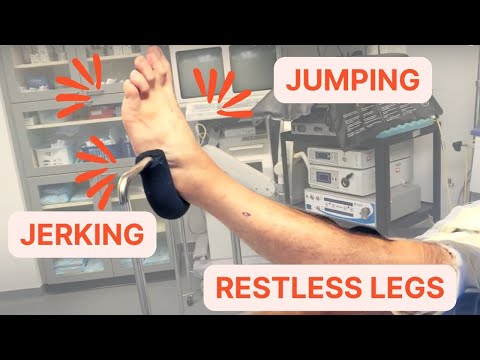 Twitching, Jumping, Jerking, Restless Leg Right Before Surgery - YouTube