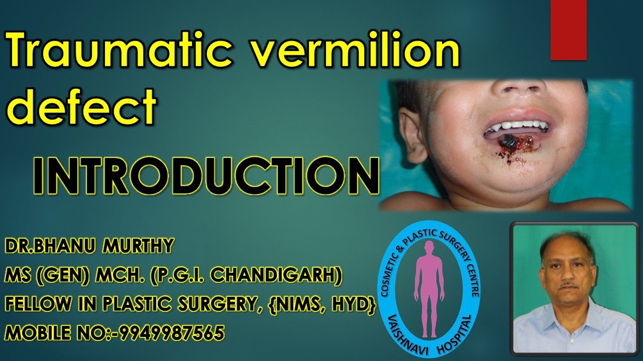 Traumatic Vermilion Defect | DR.M. BHANUMURTHY | VAISHNAVI SUPER ...