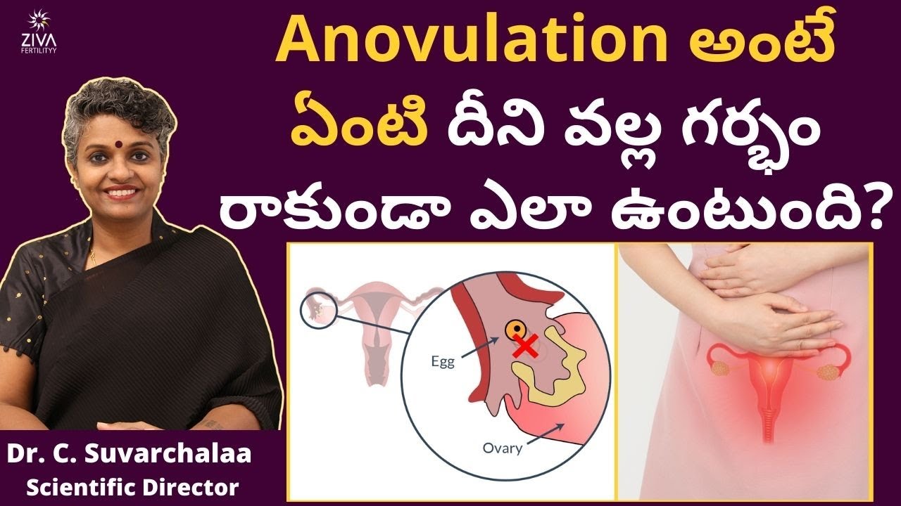 Anovulation వల్ల గర్భం || Anovulation And Infertility || Dr C ...