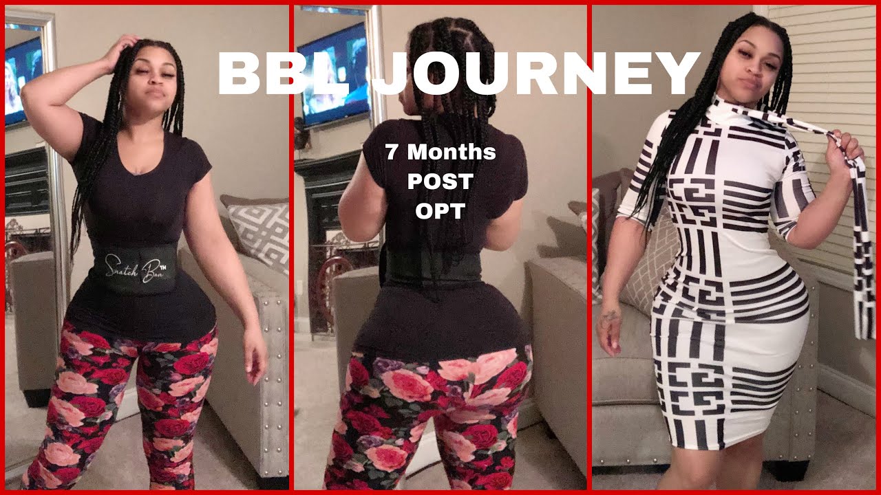 BBL JOURNEY | UPDATE 7 months post op - YouTube