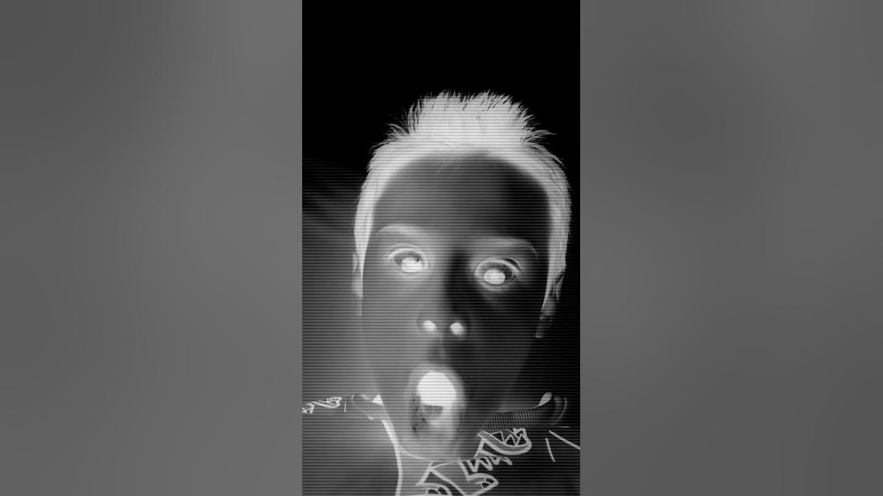 X Ray Youtube