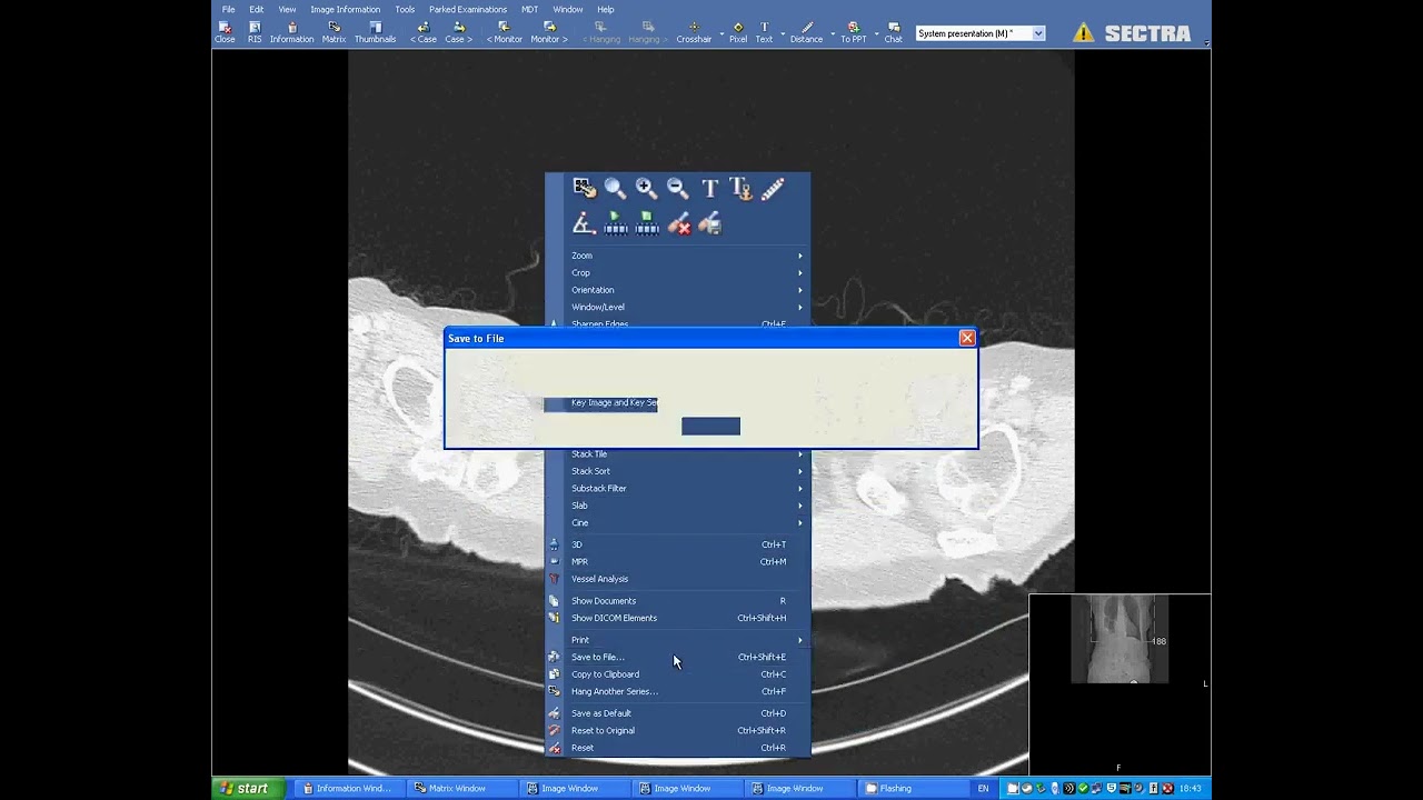 How to save DICOM files from Sectra Ids7 - YouTube