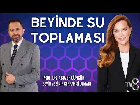 BEYİNDE SU TOPLANMASI TEDAVİ EDİLMEZSE NE OLUR? | PROF. DR. ABUZER GÜNGÖR | 8'de SAĞLIK